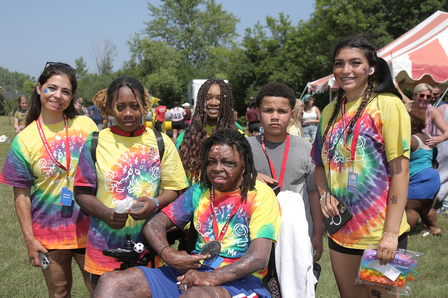 Summer Camp Offers a Place of Healing for Burn Survivors – Illinois ...